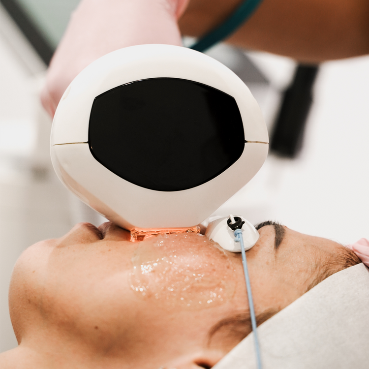 Lumecca IPL in Melbourne, Australia | Skin Bottega